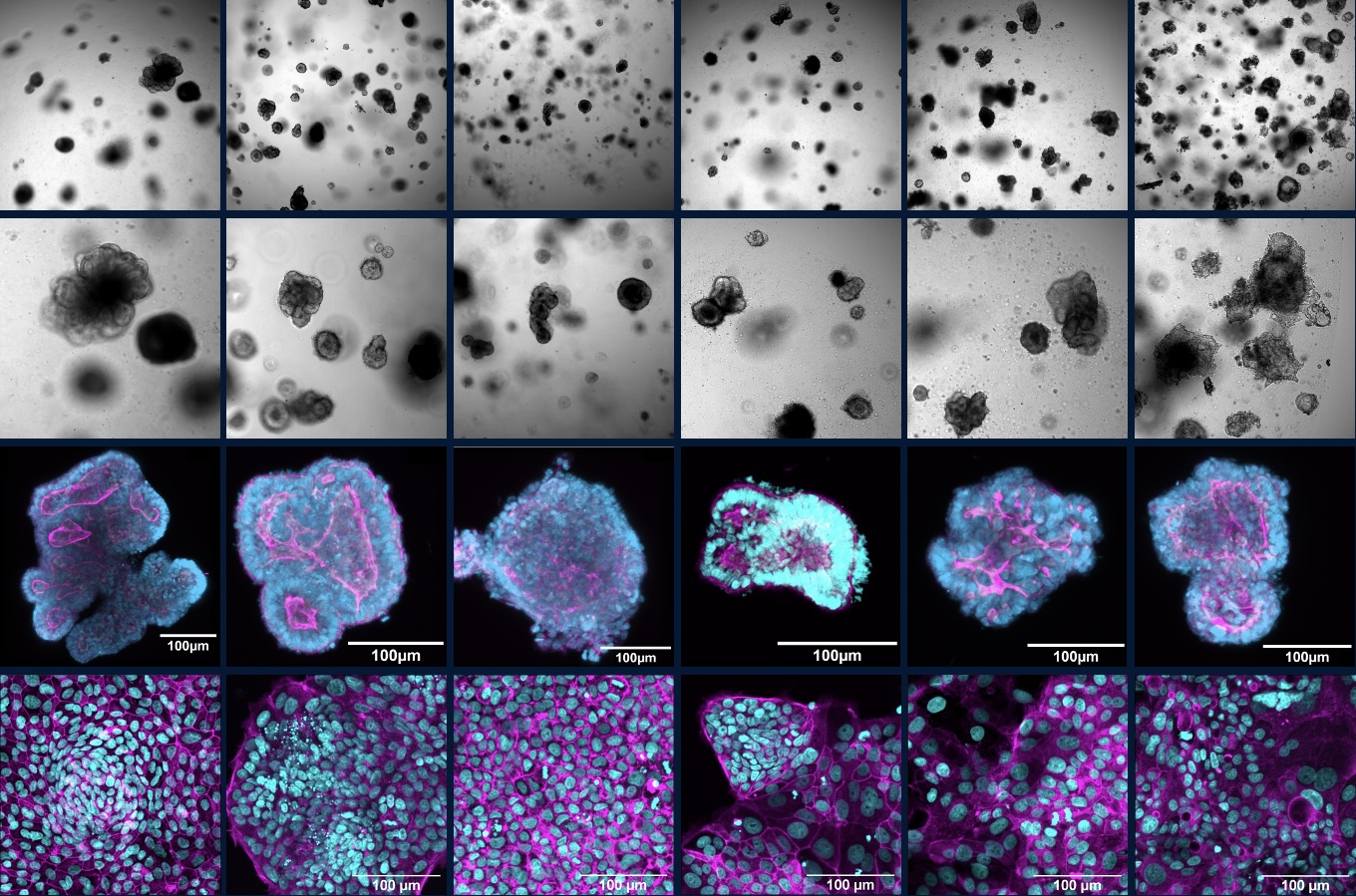 FDA Moves to Phase Out Animal Testing: A Game-Changer for Organoid ...